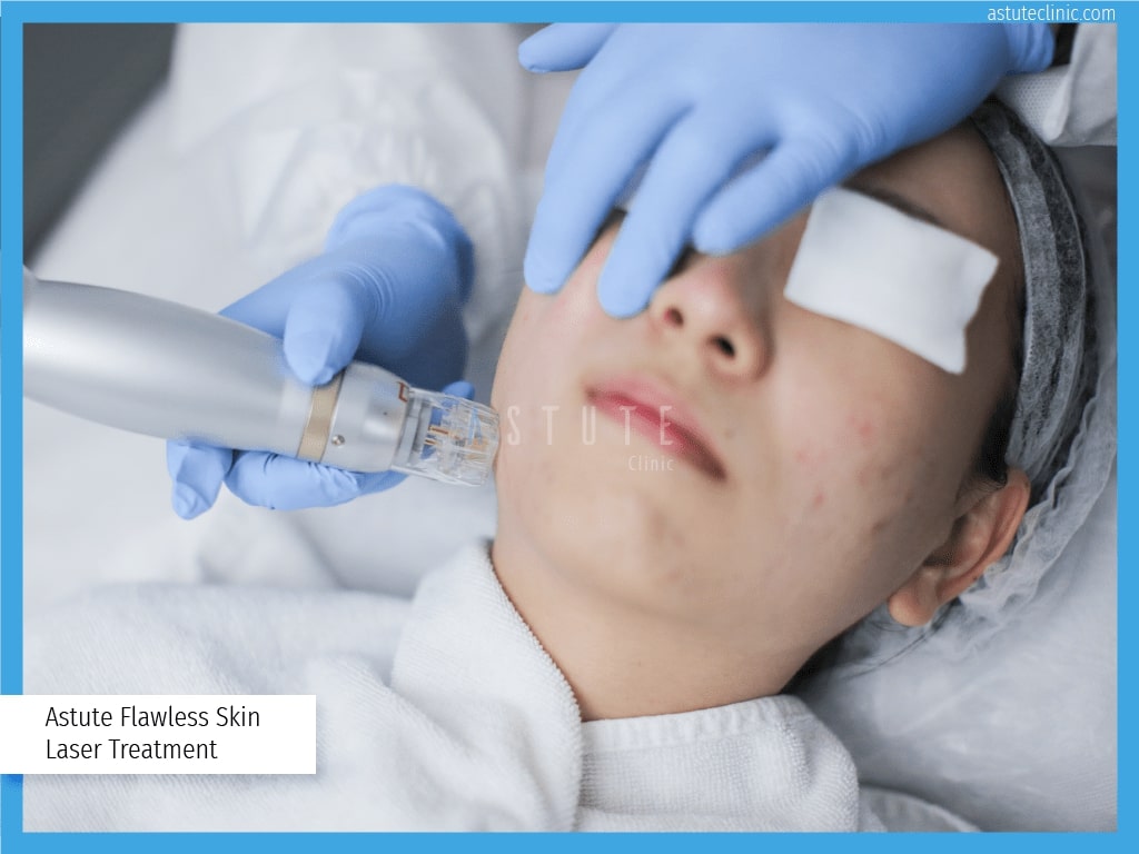 Ways to Identify and Treat Hyperpigmentation - Astute Clinic